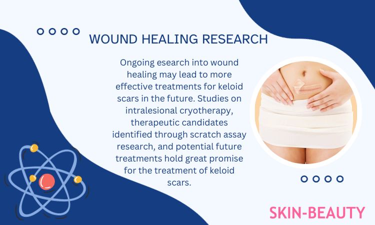 Keloid Scars: Causes, Symptoms, and Treatment Options – Skin Beauty Blog